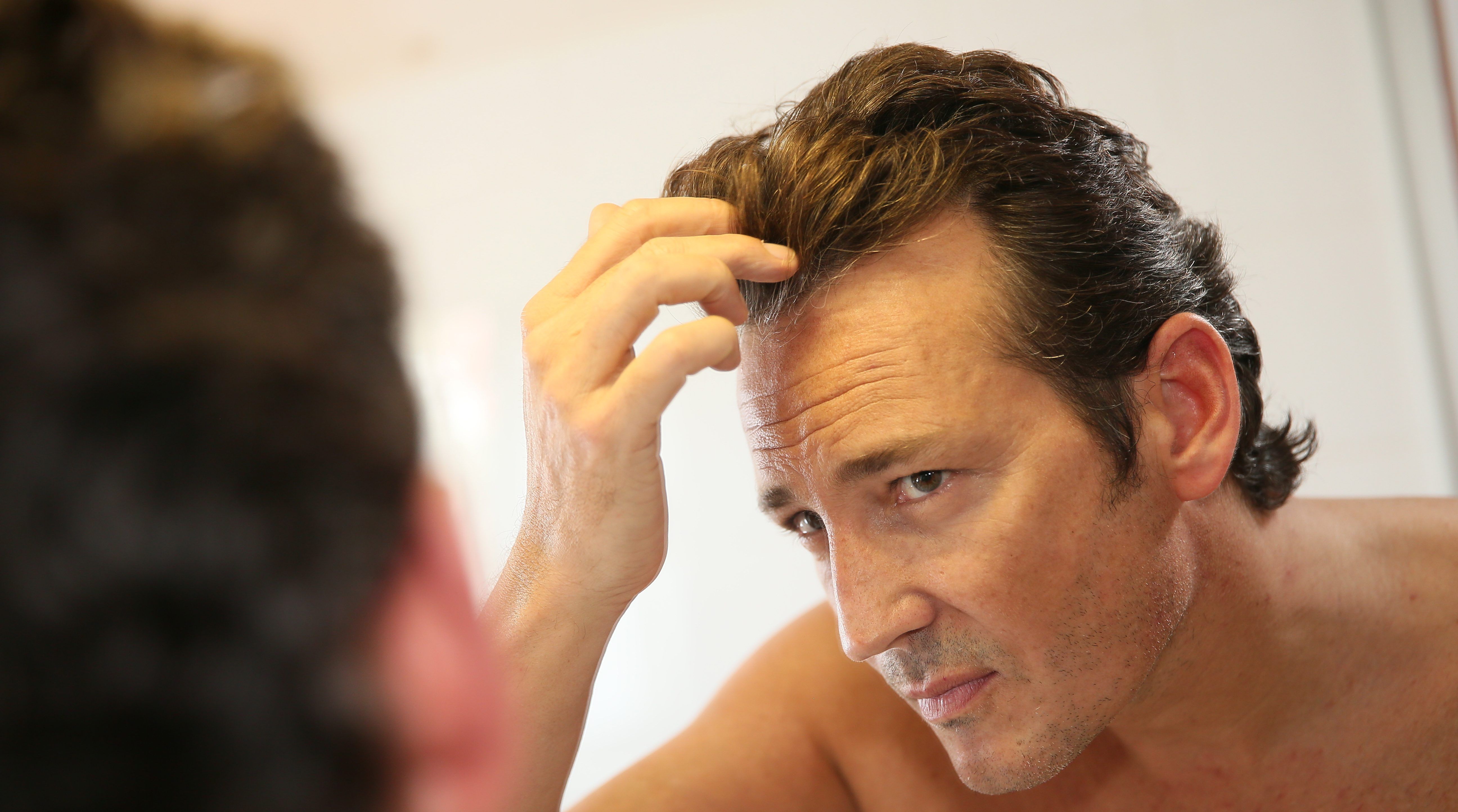 ¿Qué es la seborrea y cuáles son sus causas? - La Raza